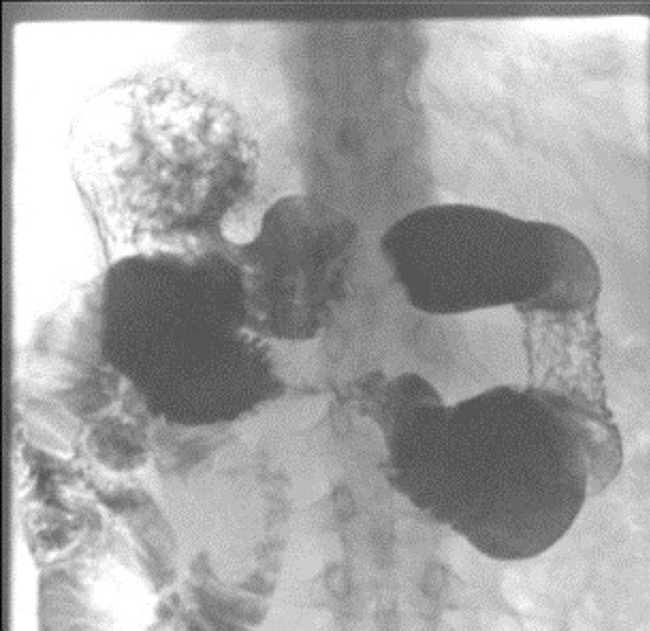 Aching and Burning Abdominal Pain in a 77-Year-Old Man | Consultant360