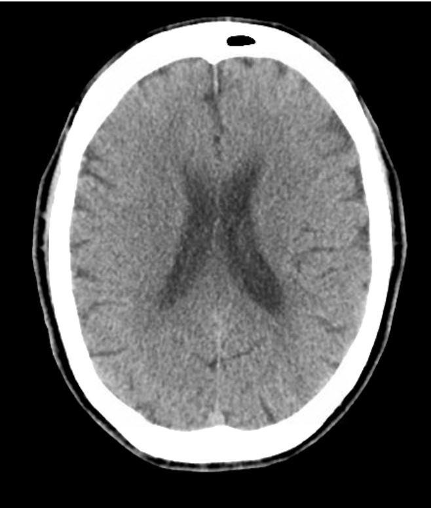 Getting a Grip on Hand Knob Stroke | Consultant360