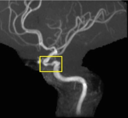 Getting a Grip on Hand Knob Stroke | Consultant360