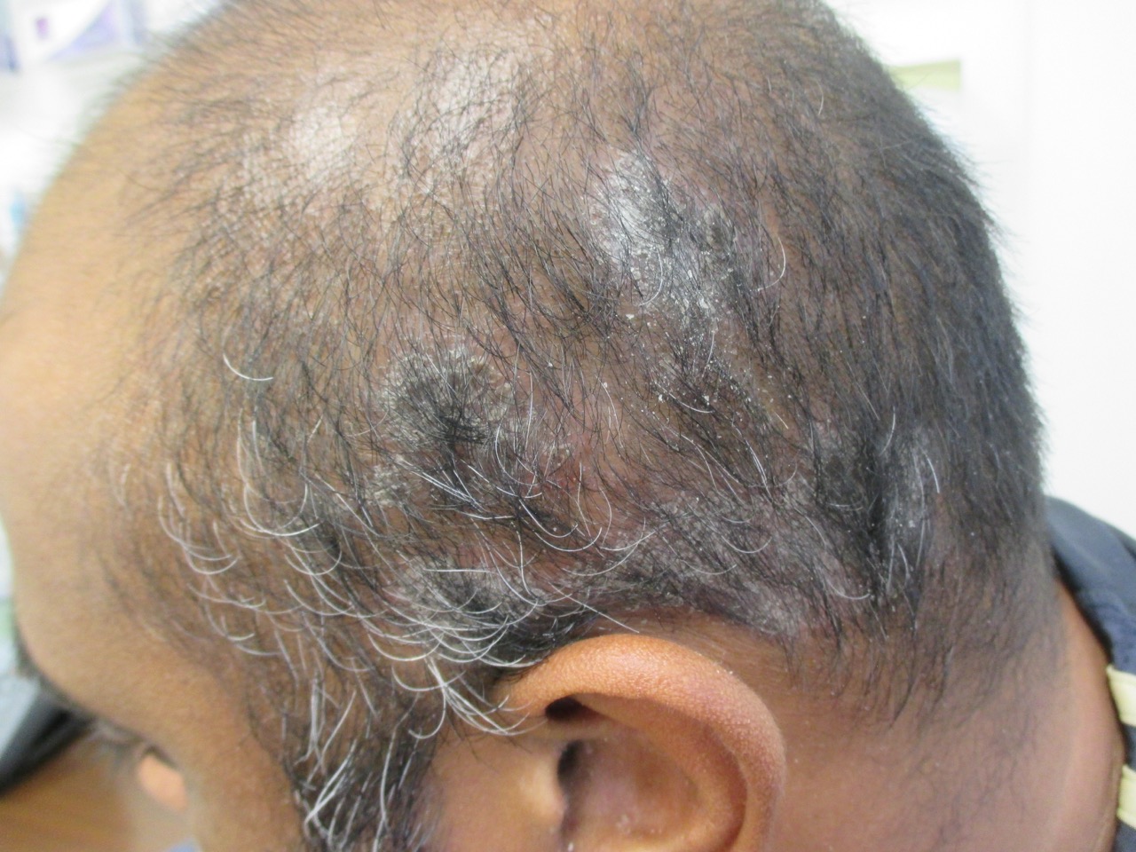 An Atlas of Nail Disorders, Part 10 | Consultant360