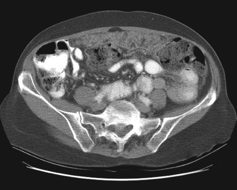 Volume 52 - Issue 7 - July 2012