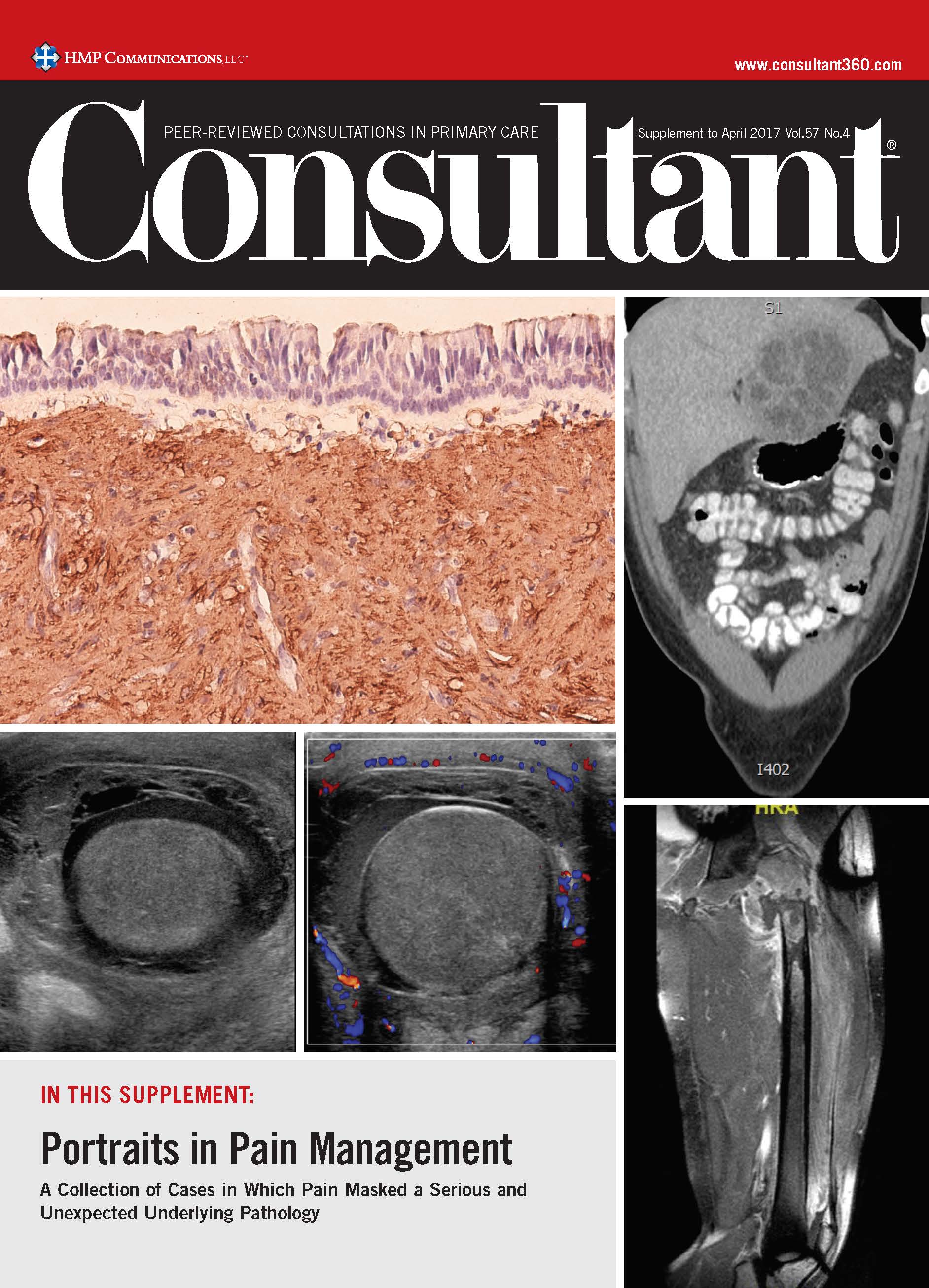Portraits in Pain Management | Consultant360