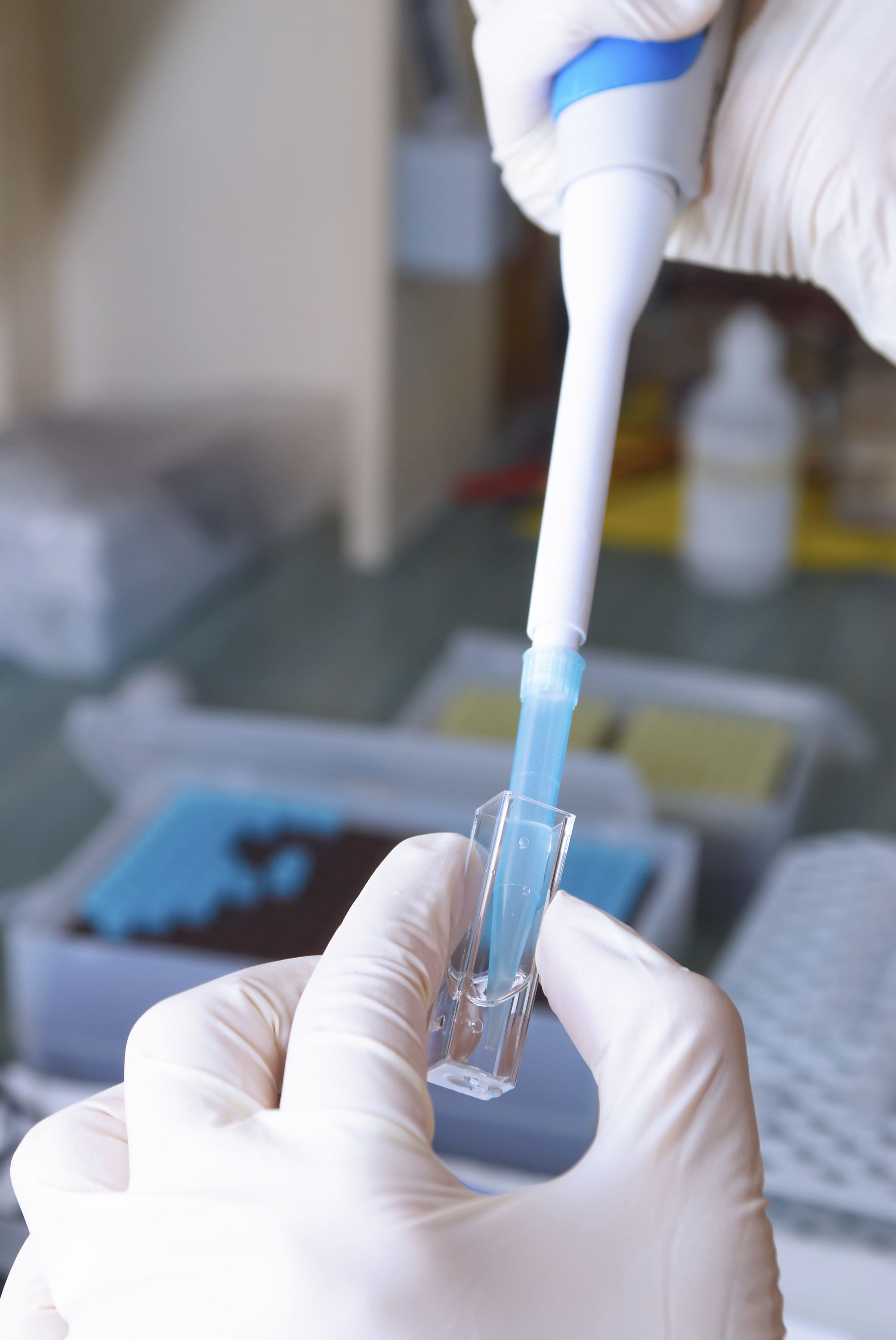 New Study Determines Normal Reference Ranges for Testosterone ...