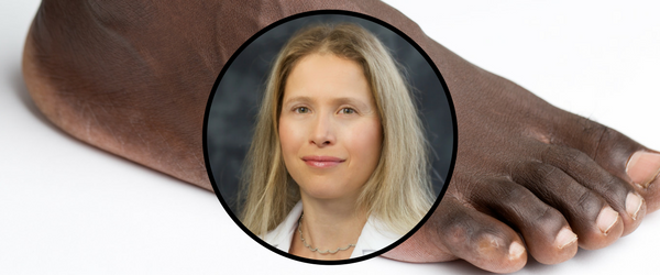 Shari Lipner, MD, on Onychomycosis Diagnosis and Treatments: What ...