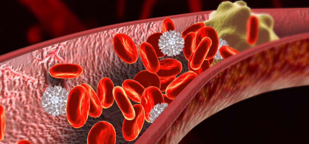 Nanoparticles Target Cardiovascular Disease | Consultant360