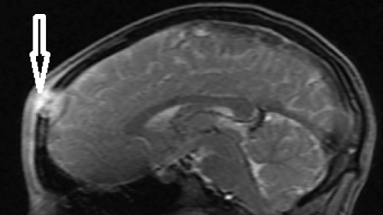 Volume 55 - Issue 6 - June 2015