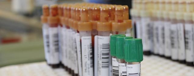 FDA: First Blood Test for Concussion Diagnosis Approved | Consultant360