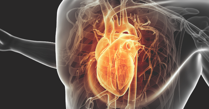 A Case of Sudden Cardiac Death in a High School Athlete | Consultant360