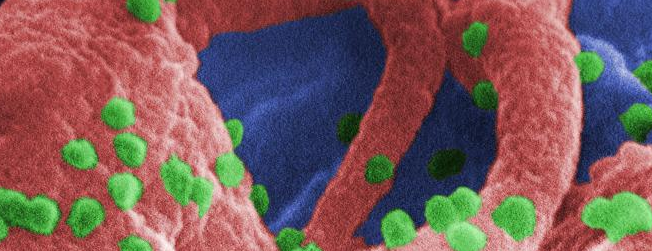 Recent Study Sheds New Light on HIV Pathogenesis | Consultant360