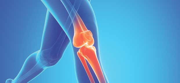 Joint Inflammation Associated With Pain Sensitization in Knee ...