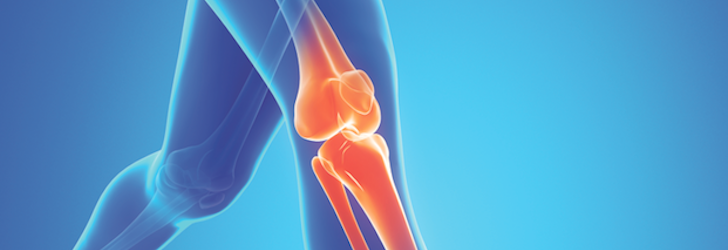 Knee Popping and Cracking May Signal Future OA | Consultant360