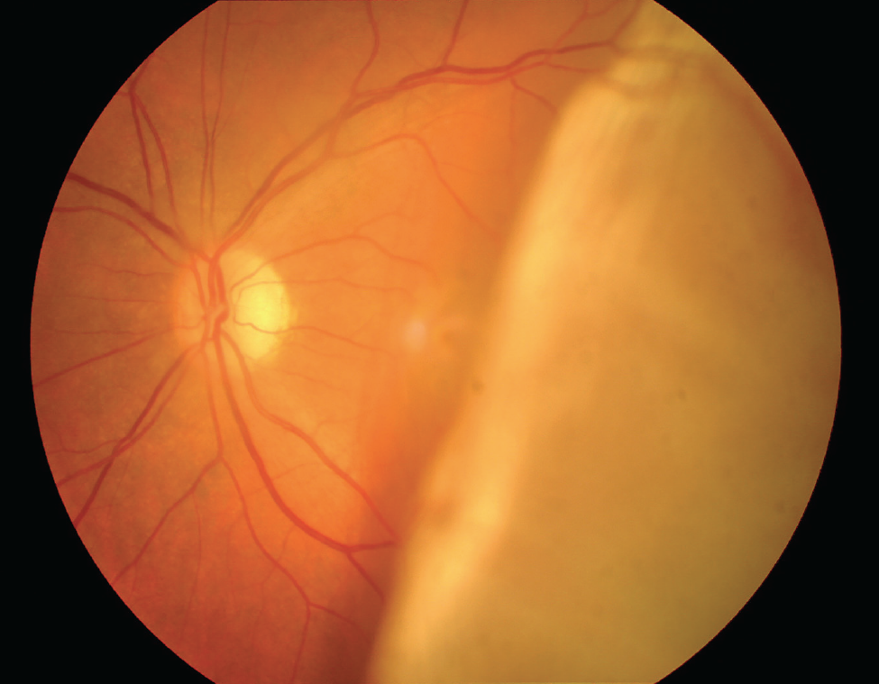 Ocular Emergencies in Primary Care: Diagnosis, Treatment, and Referral ...