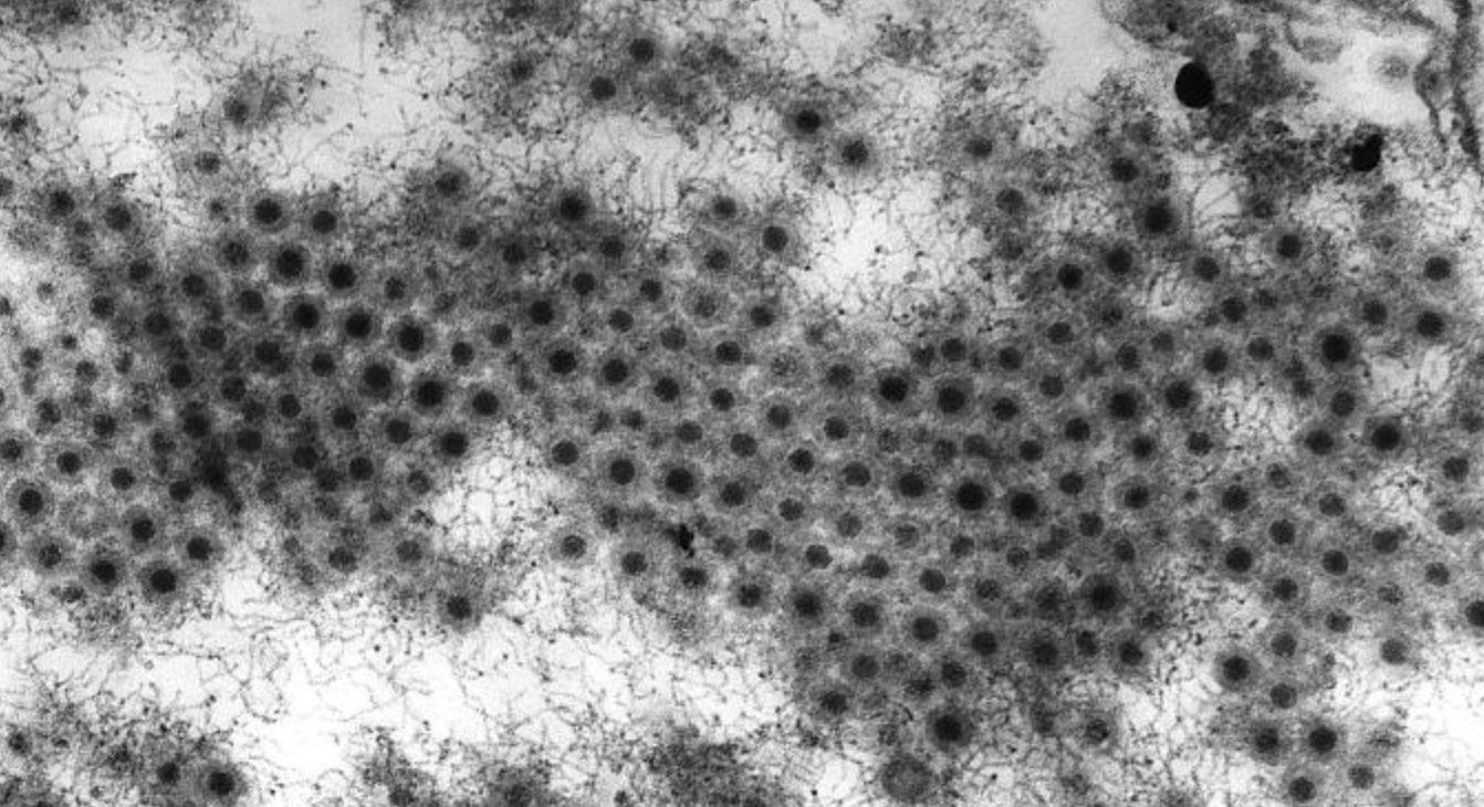 Could a Common Cold Virus Inhibit Hepatitis C? | Consultant360