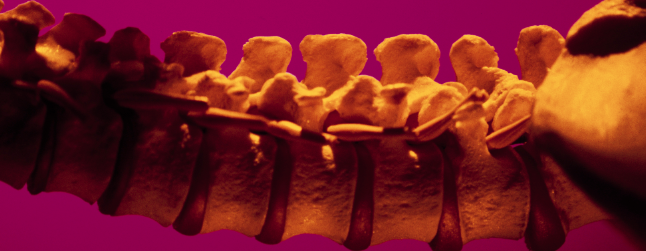 Could Oral Prednisone Improve Sciatica Outcomes? | Consultant360