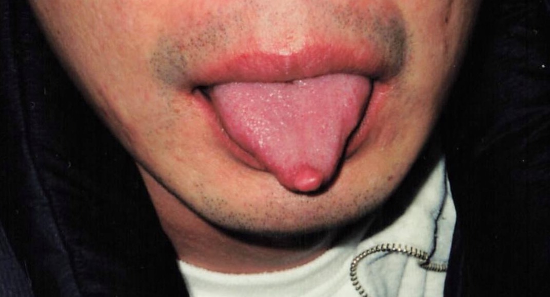 An Atlas of Lumps and Bumps: Part 14 | Consultant360