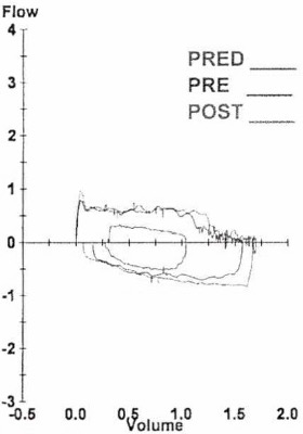 Tracheal Stenosis After Prolonged Invasive Mechanical Ventilation: An ...
