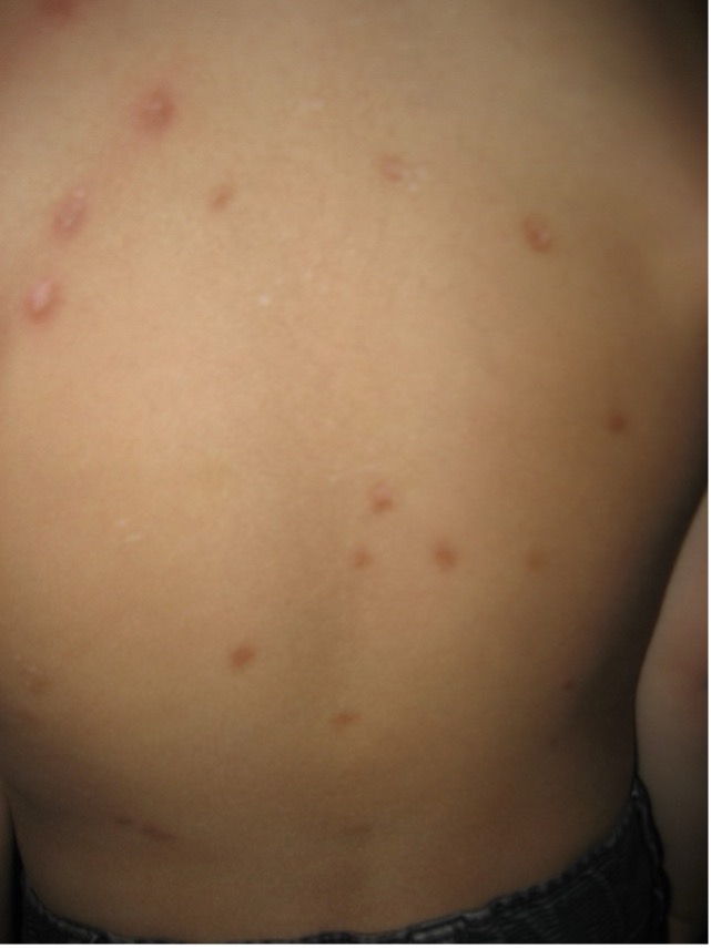 An Atlas of Lumps and Bumps, Part 50: Maculopapular Cutaneous ...