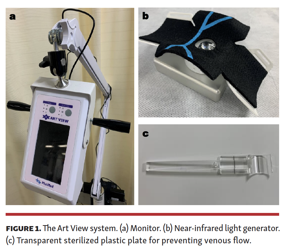 First Reported Use of a Visualization Device for the Radial Artery With ...