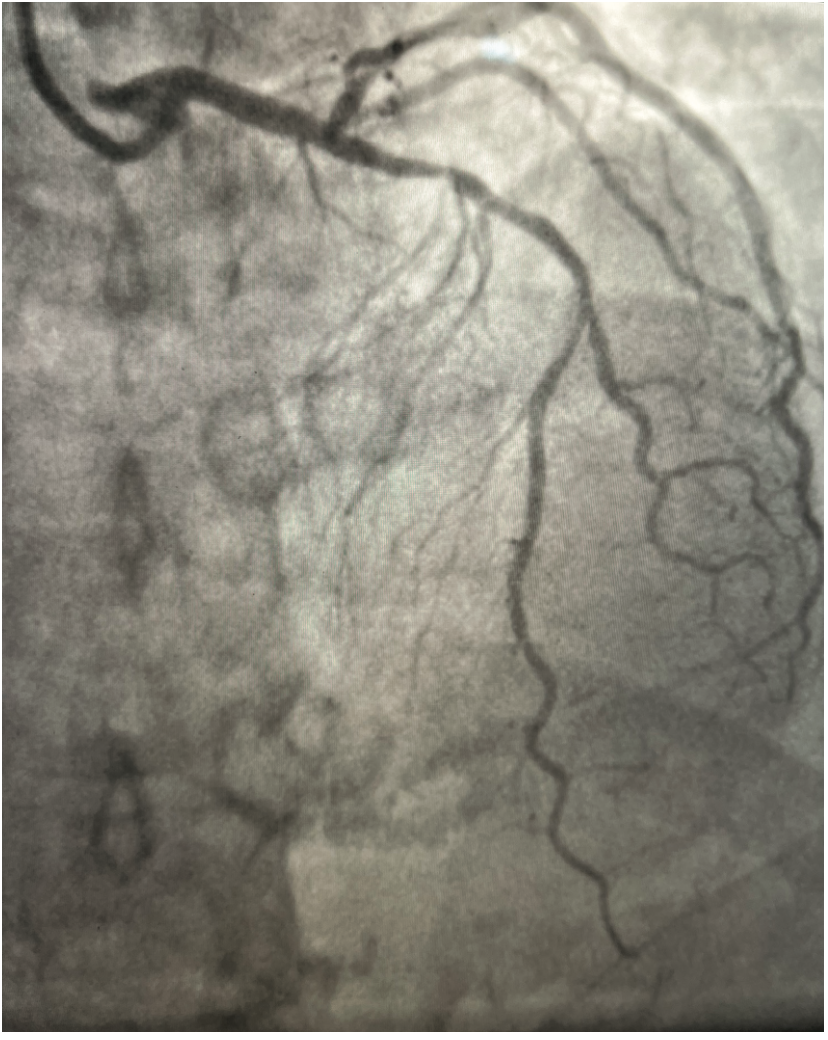Routine Defibrillator Pad Placement: For All Patients in the Cardiac ...