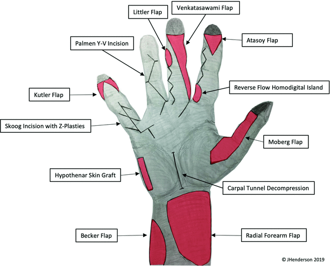 Volume 20 ePlasty | ePlasty