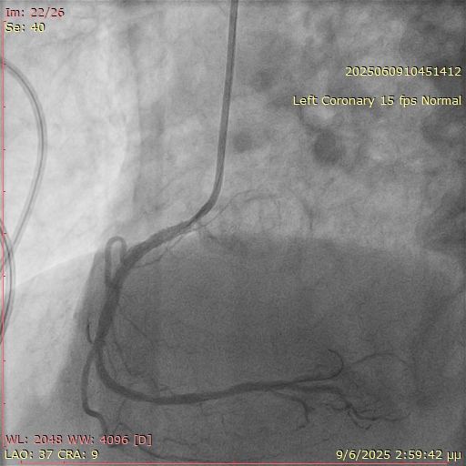 Opening the Way! Fenestration of a Malpositioned Ostial Right Coronary ...