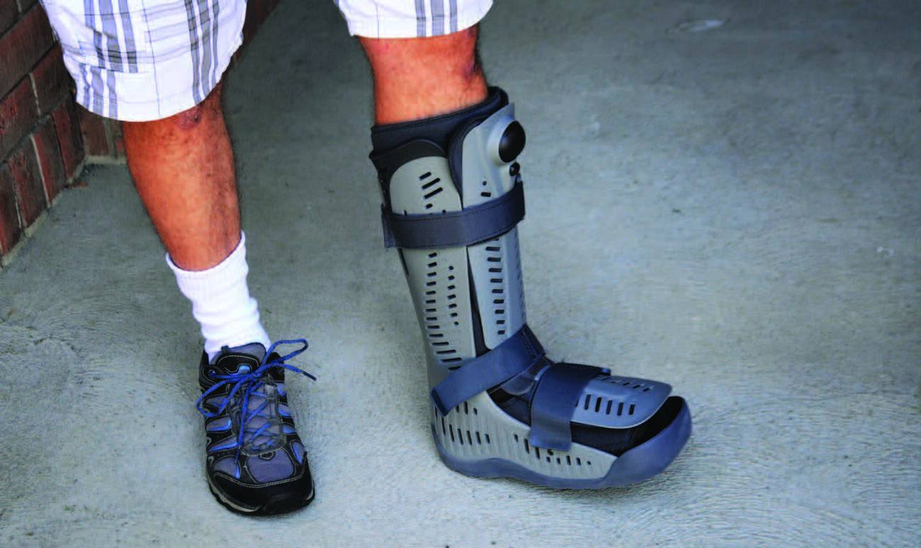 Early Weight-Bearing Following Ankle Fracture ORIF