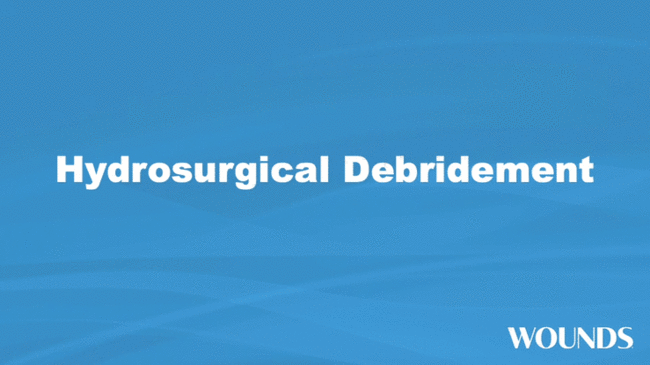 Hydrosurgical Debridement Wounds Research